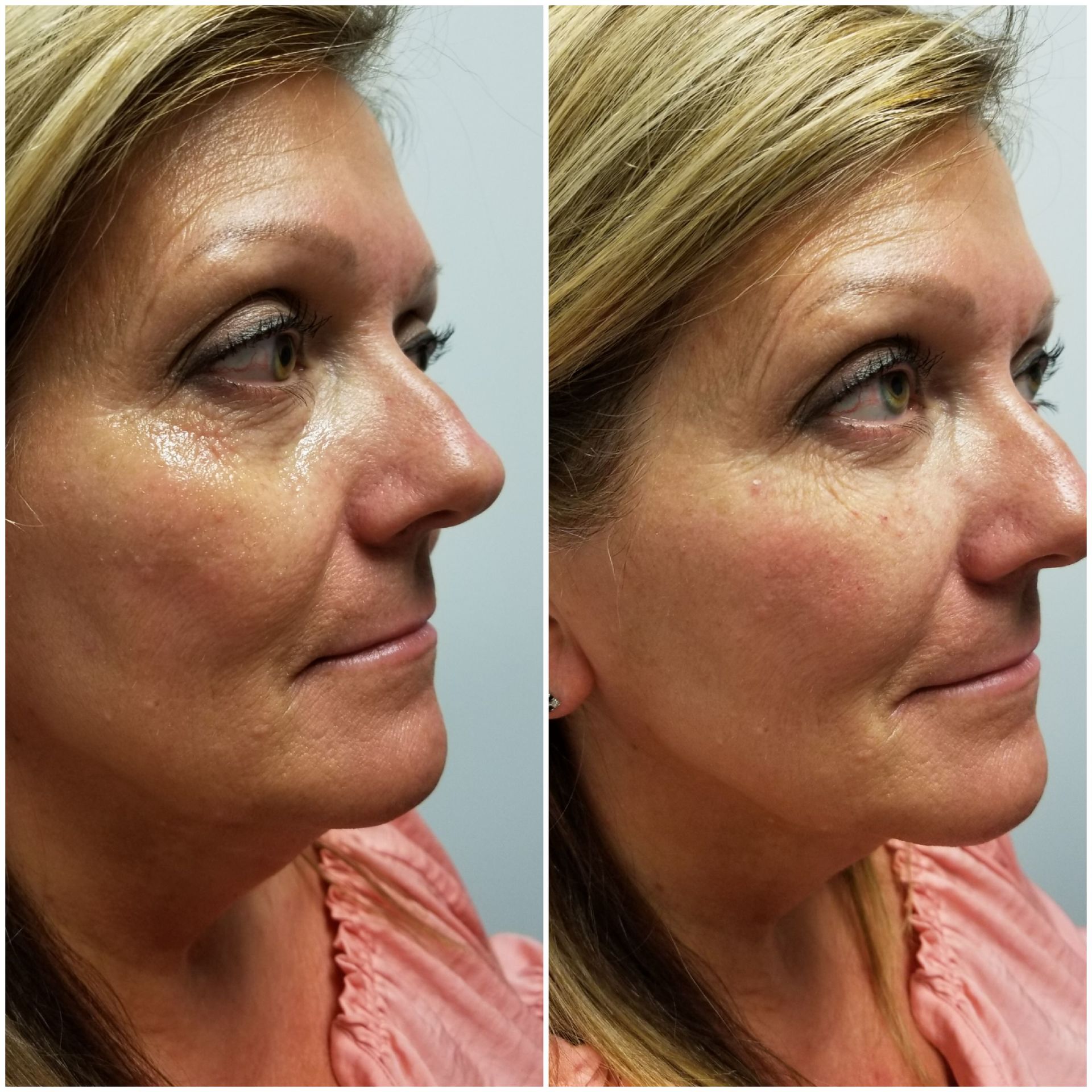 Natural Injections Med Spa by Laura
