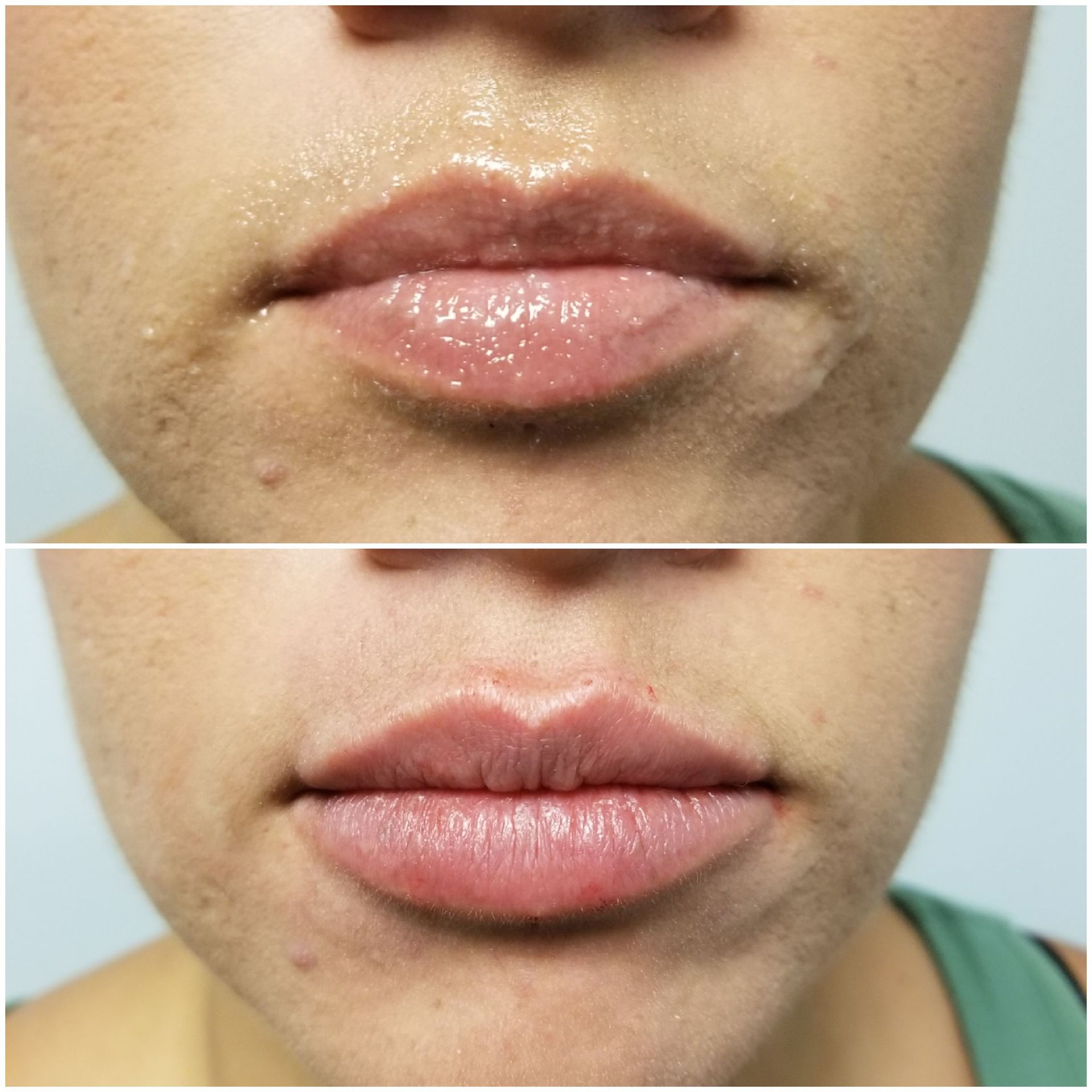 Natural Injections Med Spa by Laura