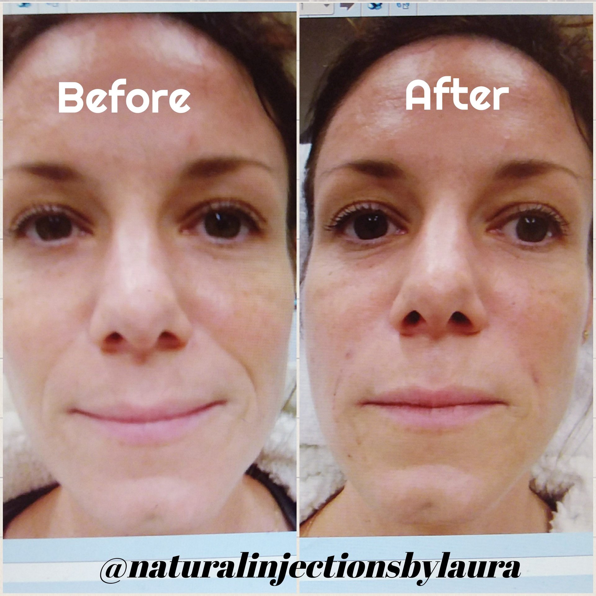 Natural Injections Med Spa by Laura