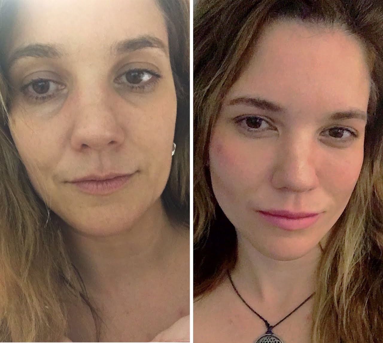 Natural Injections Med Spa by Laura