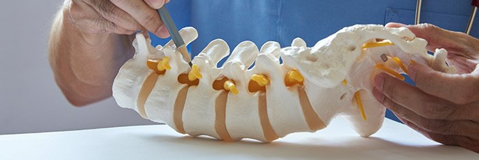 Biziondo: Traumatólogos de columna