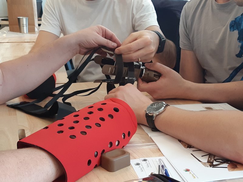 Das Projekt The Hand Project die Geschichte der Handprothese