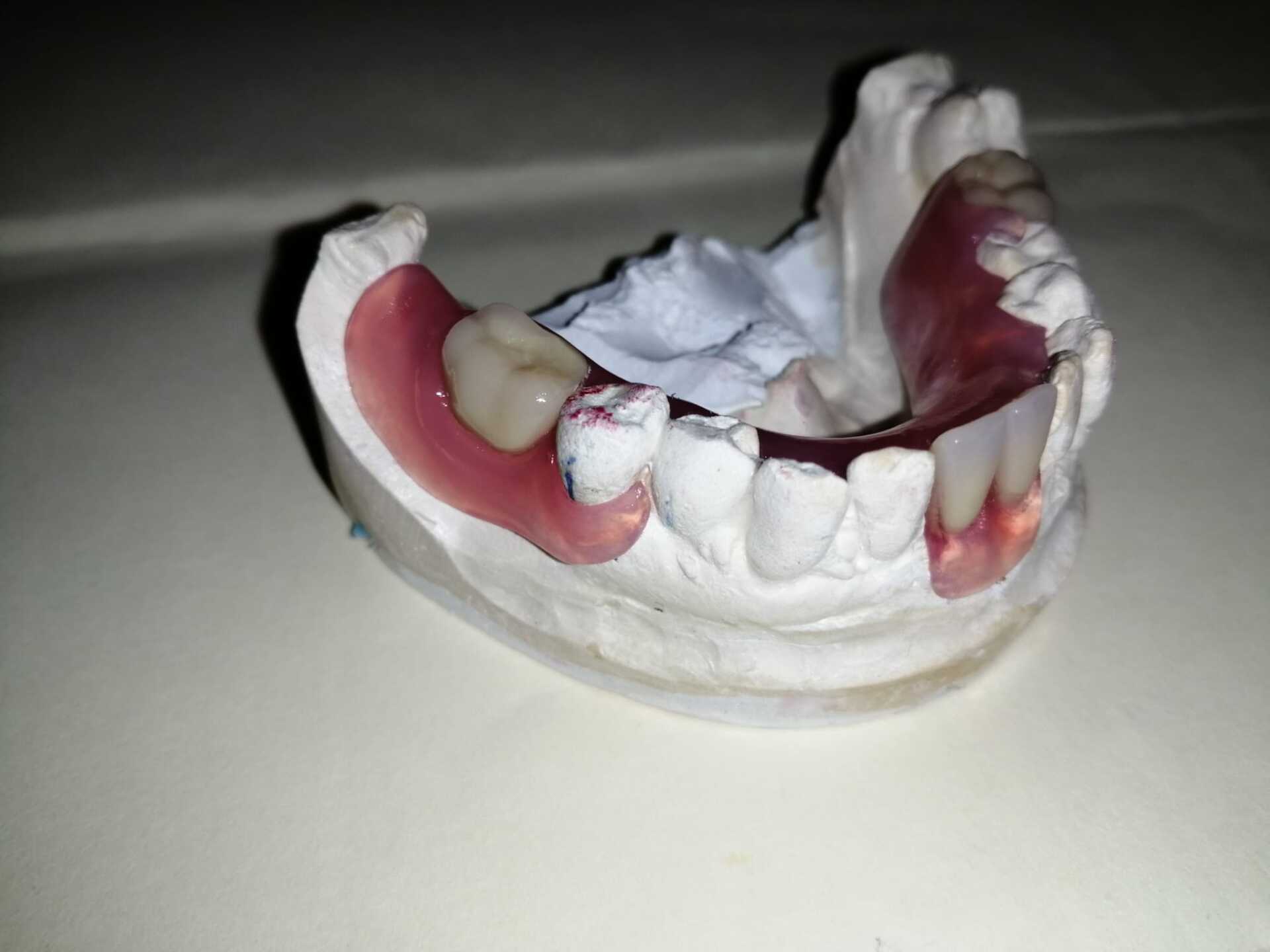 Unident Bilbao - Laboratorio de Prótesis Dental en Bilbao