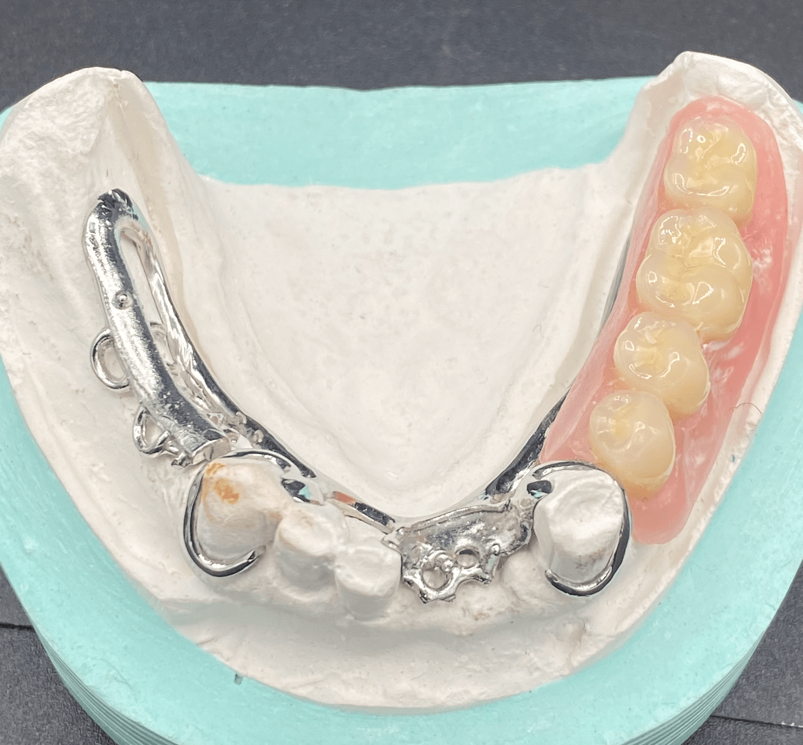 LABORATOIRE PROTHESE DENTAIRE ESTHETICDENT