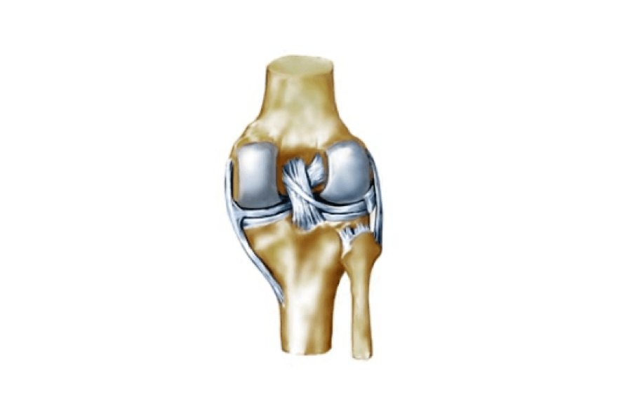 Dolor de rodilla. Causas y posibles tratamientos | Cognitiva