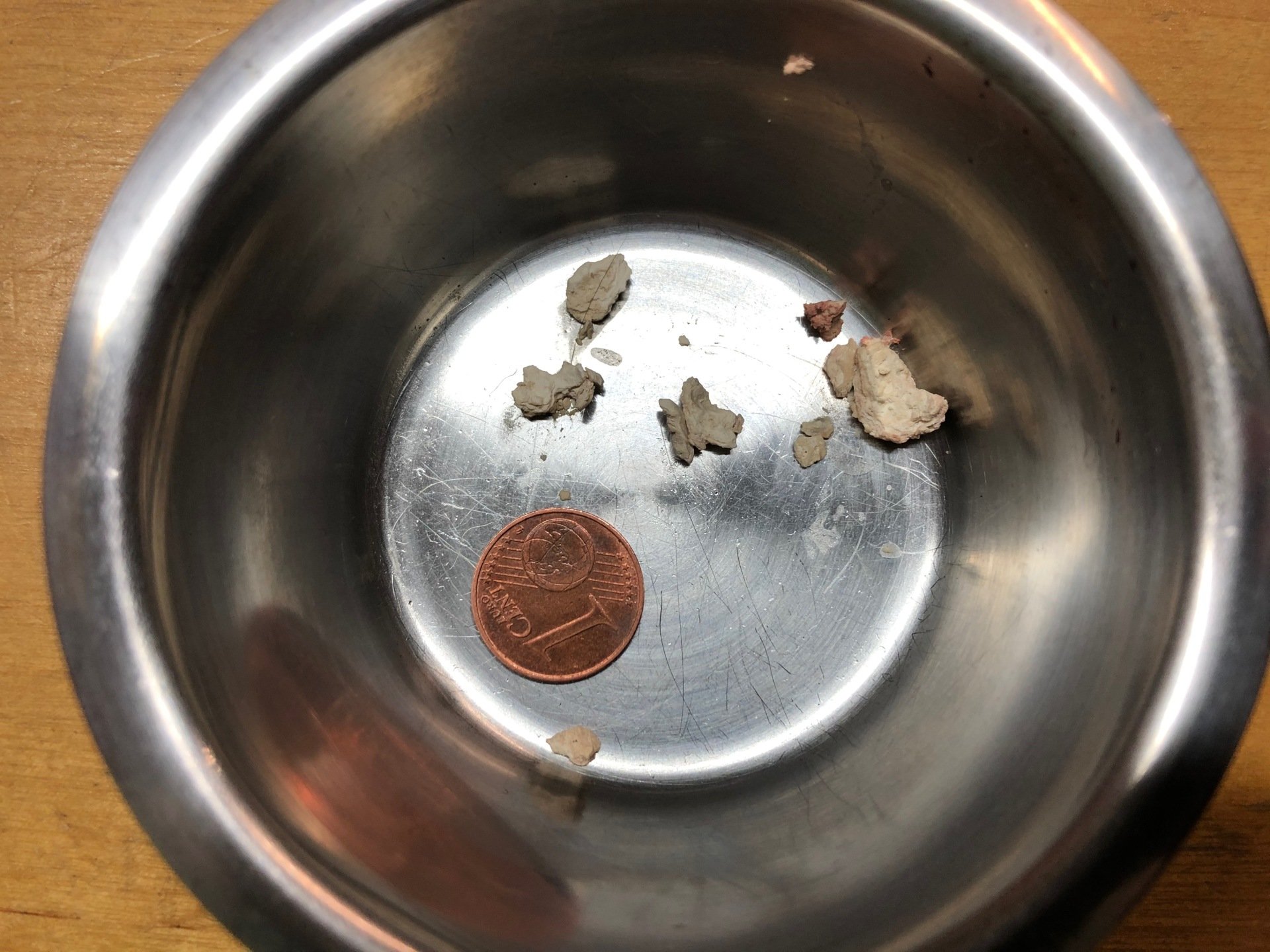 Harnröhren- bzw Blasensteine