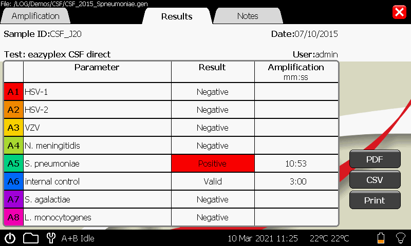 eazyplex® CSF direct