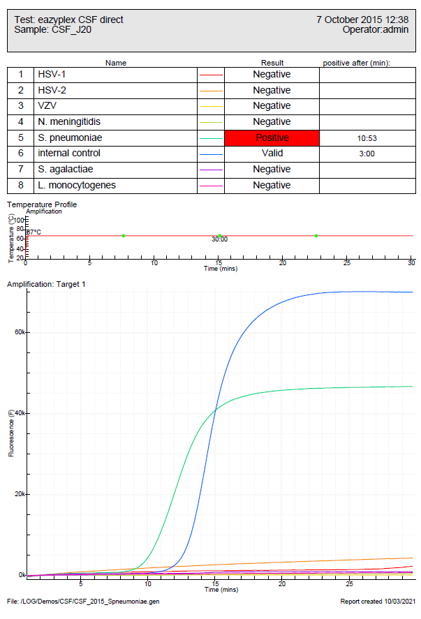 eazyplex® CSF direct