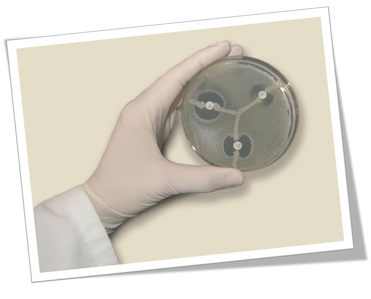 eazyplex® SuperBug complete