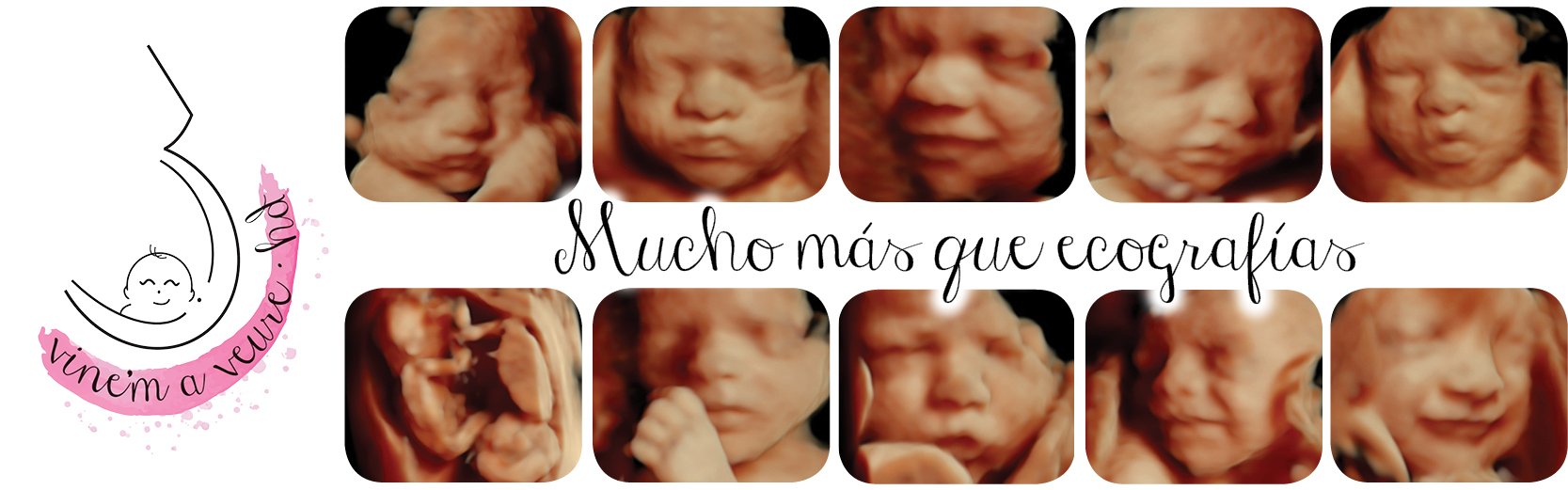 Preguntas y respuestas sobre la ecografía 5D