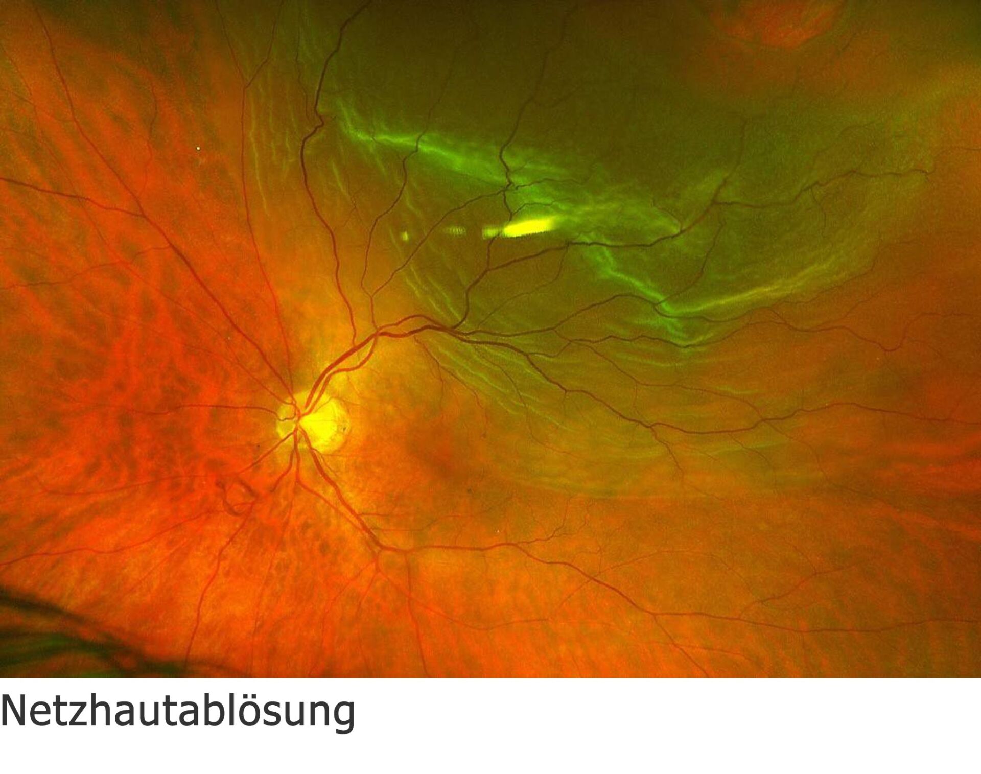 Aufbau und Funktion des Auge