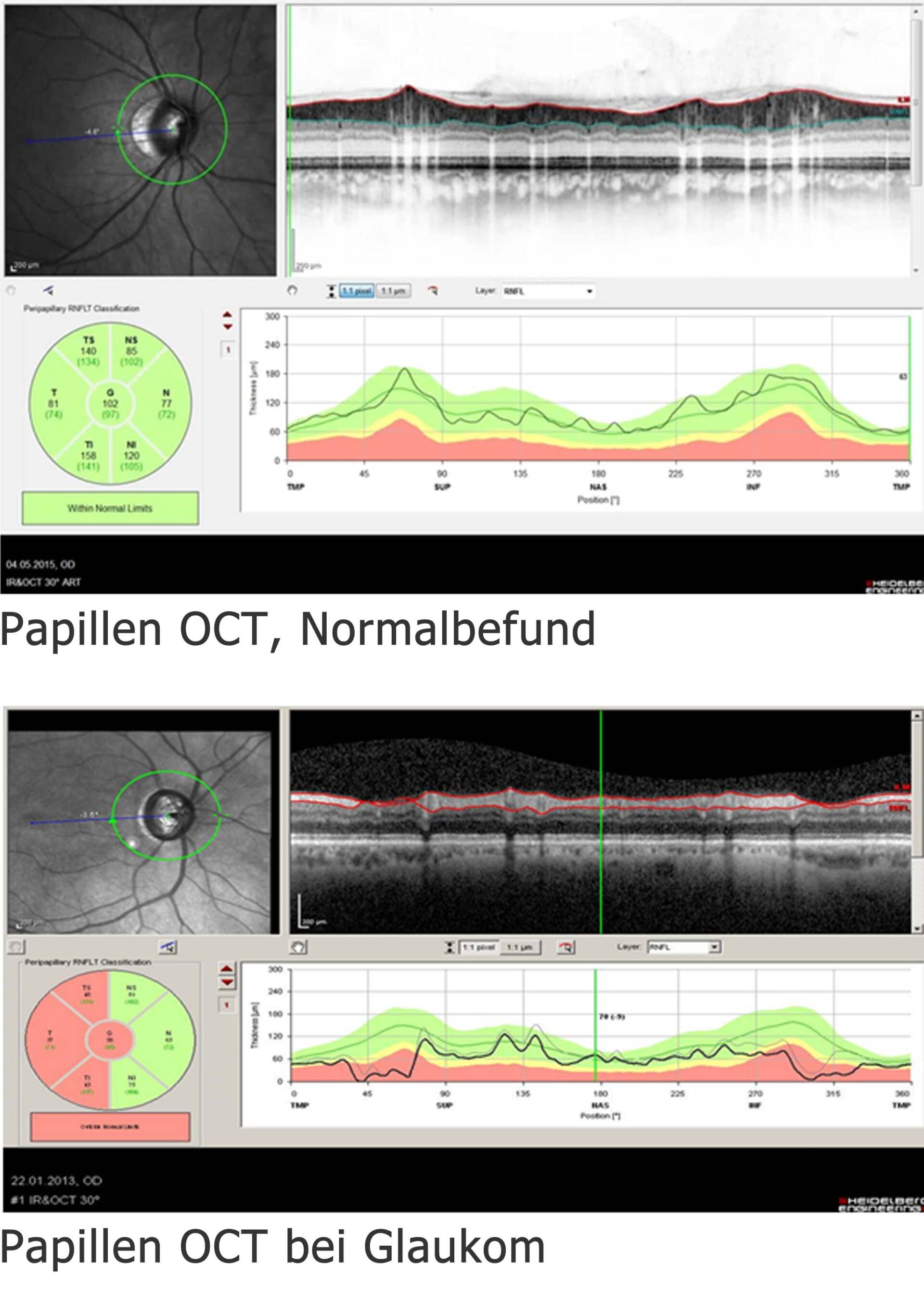 Augenärztliche Behandlungen: Diagnostik und Vorsorgeuntersuchungen