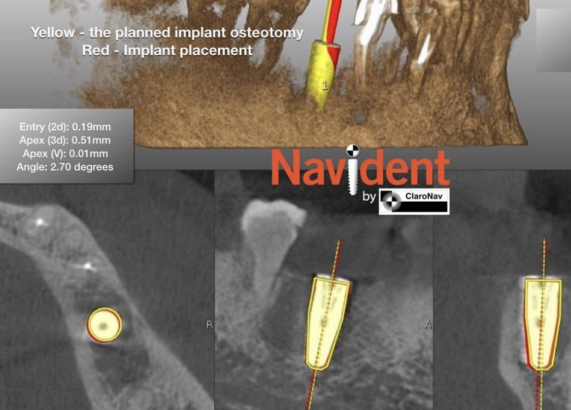 Navident - dynamische Echtzeit-Navigation