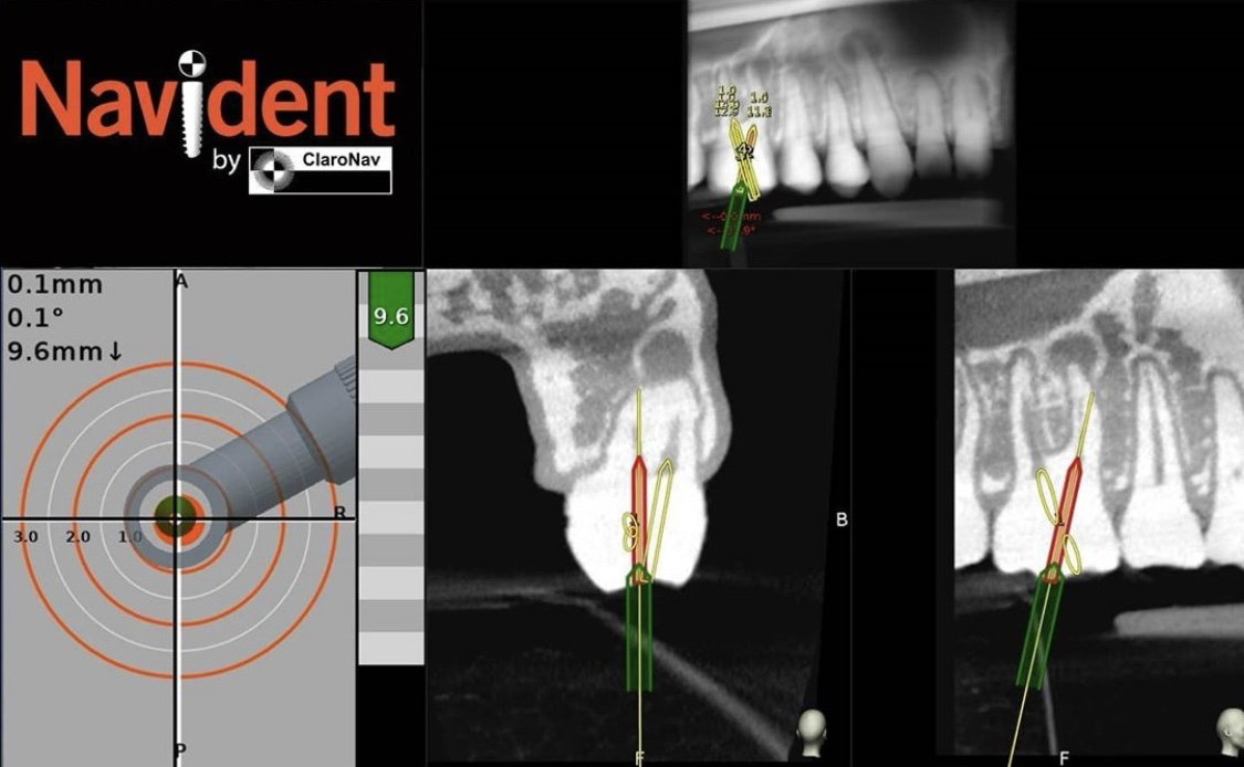 Navident - dynamische Echtzeit-Navigation