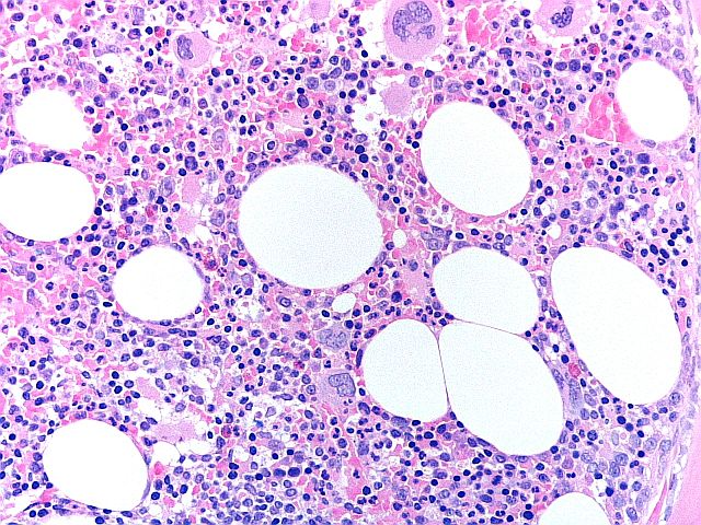 UK NEQAS CPT – Cellular Pathology EQA Services & Information