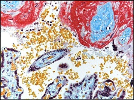 UK NEQAS CPT – Cellular Pathology EQA Services & Information