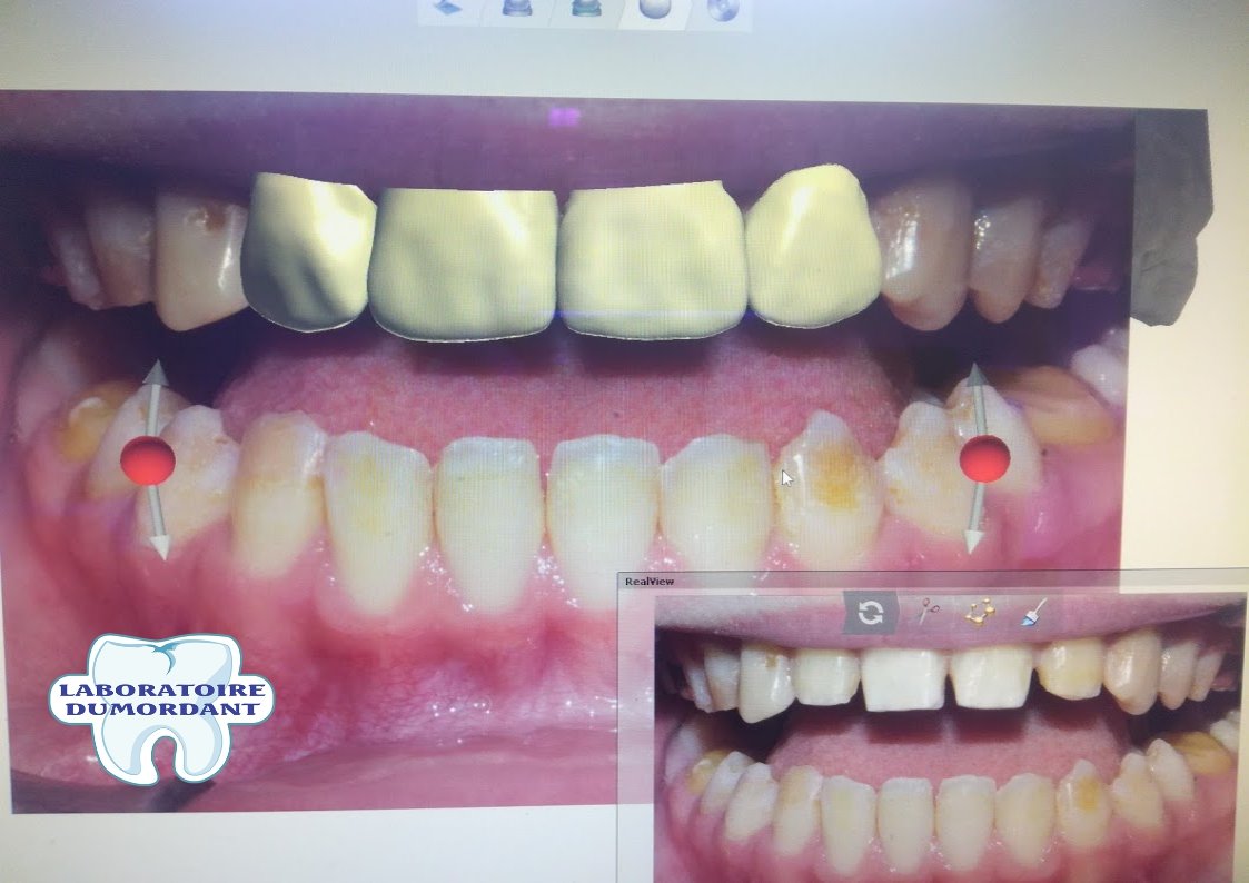 digital smile design,dsd