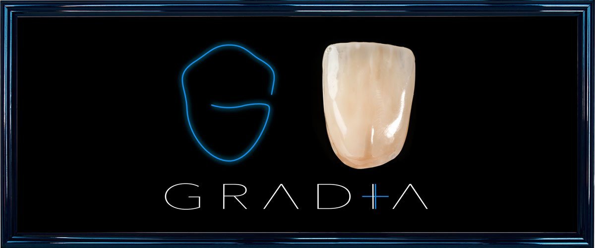gc gradia , composite dentaire