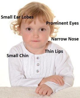 Vascular Ehlers-Danlos Syndrome - UK Registered Charity