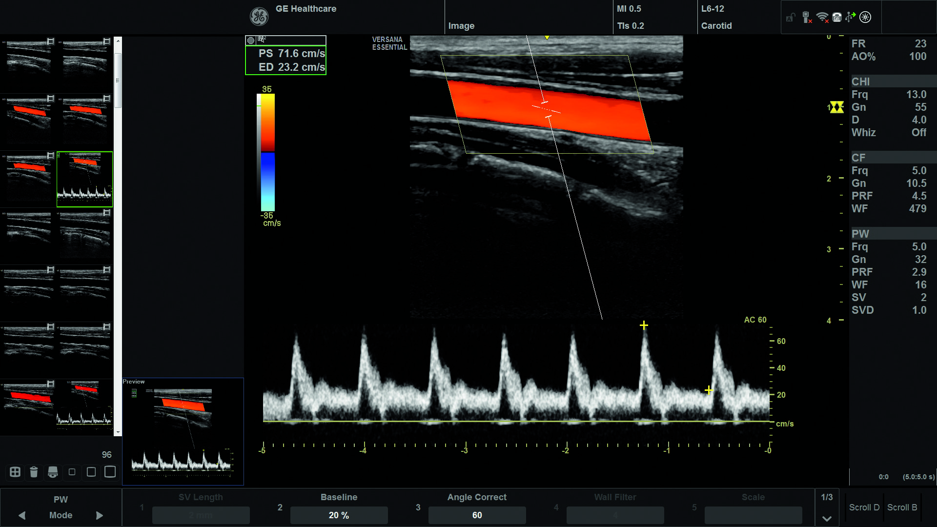 GE Versana Essential günstiges Ultraschallgerät - SONOFAIR.de