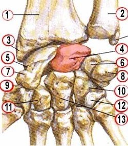 Lunatummalazie, Lunatumnekrose, Morbus Kienböck, Mondbeintod, Kienböcks ...