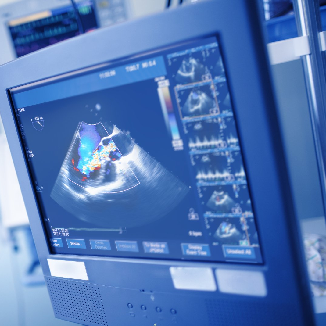 Wahlarztordination Dr. Tina Windschnurer - Herzultraschall