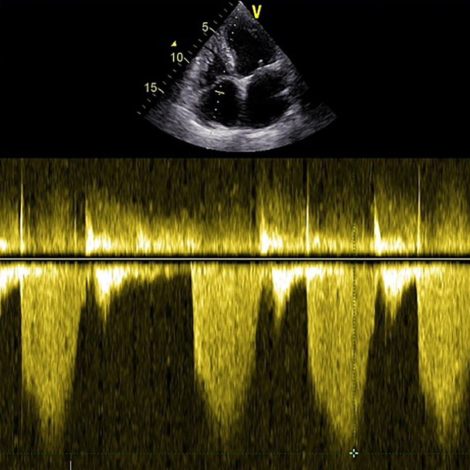 Wahlarztordination Dr. Tina Windschnurer - Herzultraschall