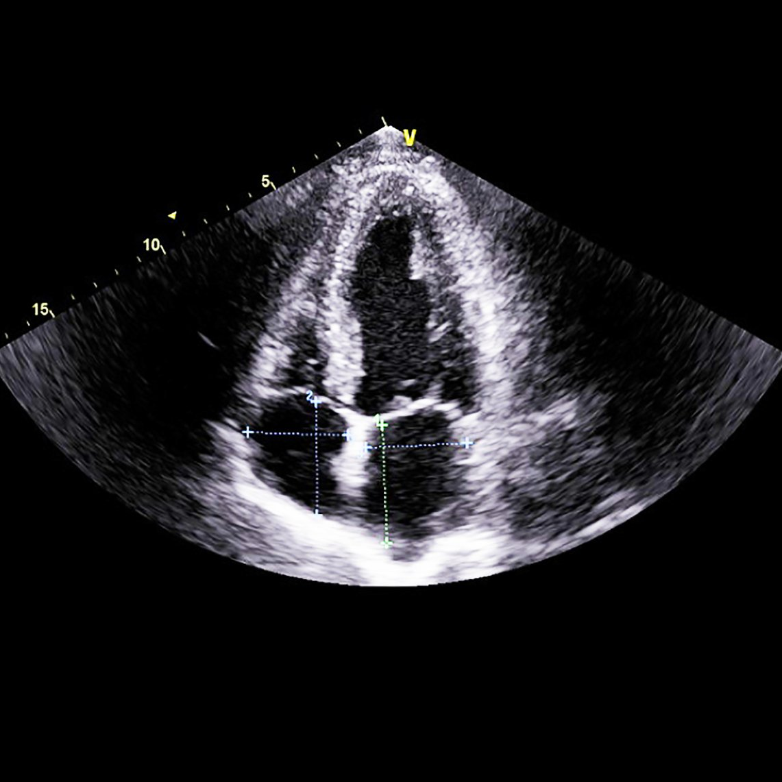 Wahlarztordination Dr. Tina Windschnurer - Herzultraschall