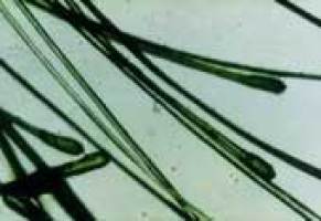 Dr. Nabielek - Gynäkologie - Trichogramm