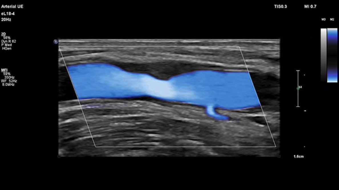 Galerie Centre Medivasc Comédie Angiologue Montpellier Echo-doppler