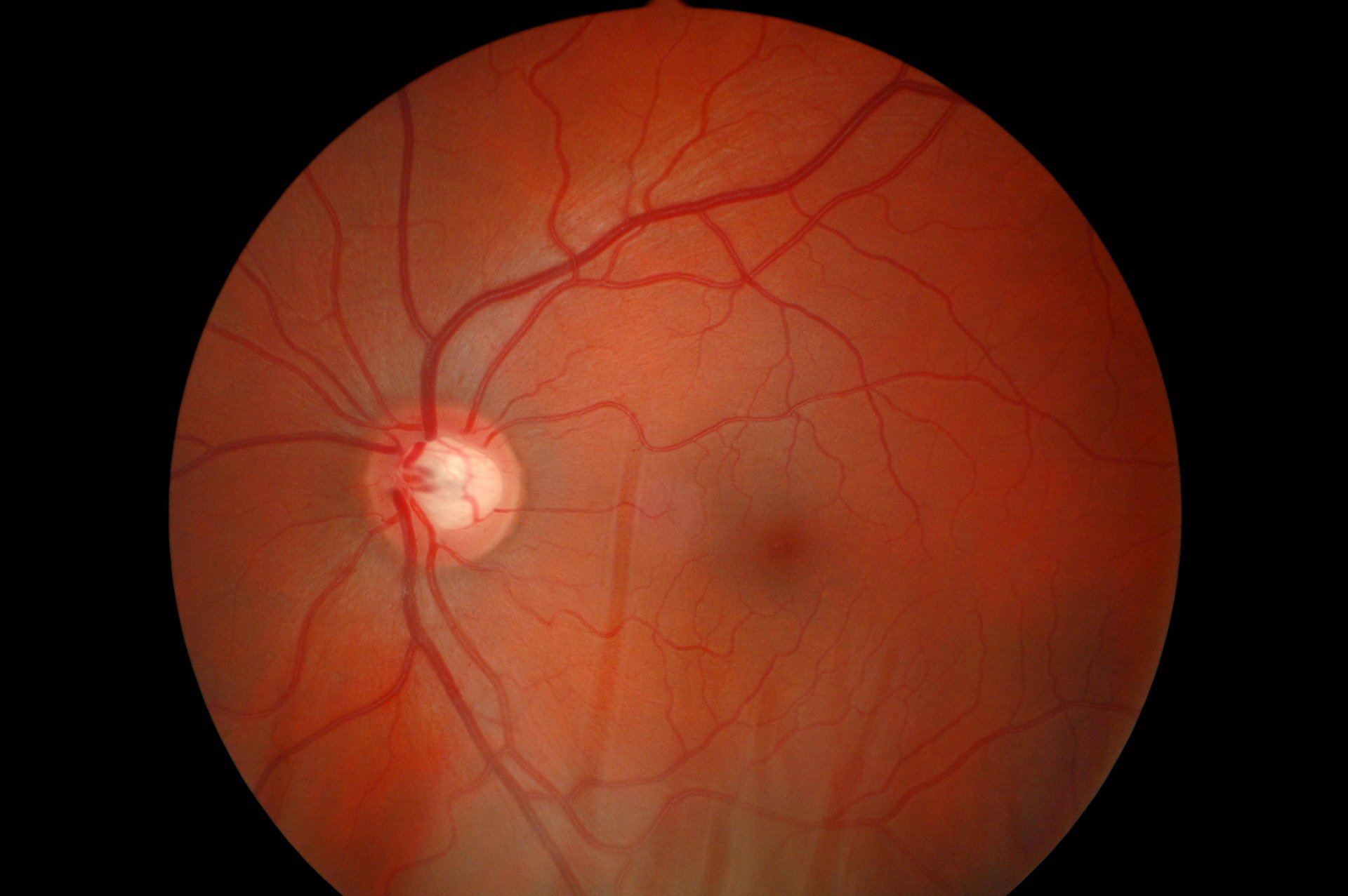 Augengesundheitsvorsorge - mehr als nur ein Sehtest.