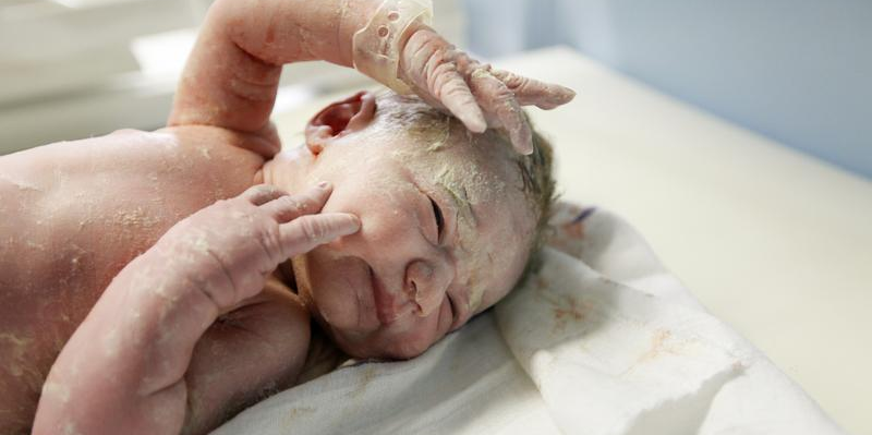 Vérnix caseoso ¿qué es?