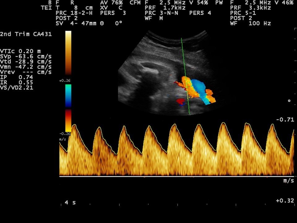 Ultrasoundpartners| Private pregnancy scan near you